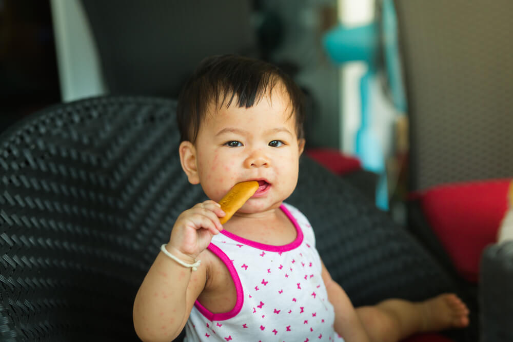 Mononucleoza infecțioasă (boala sărutului): simptome, diagnostic și ...